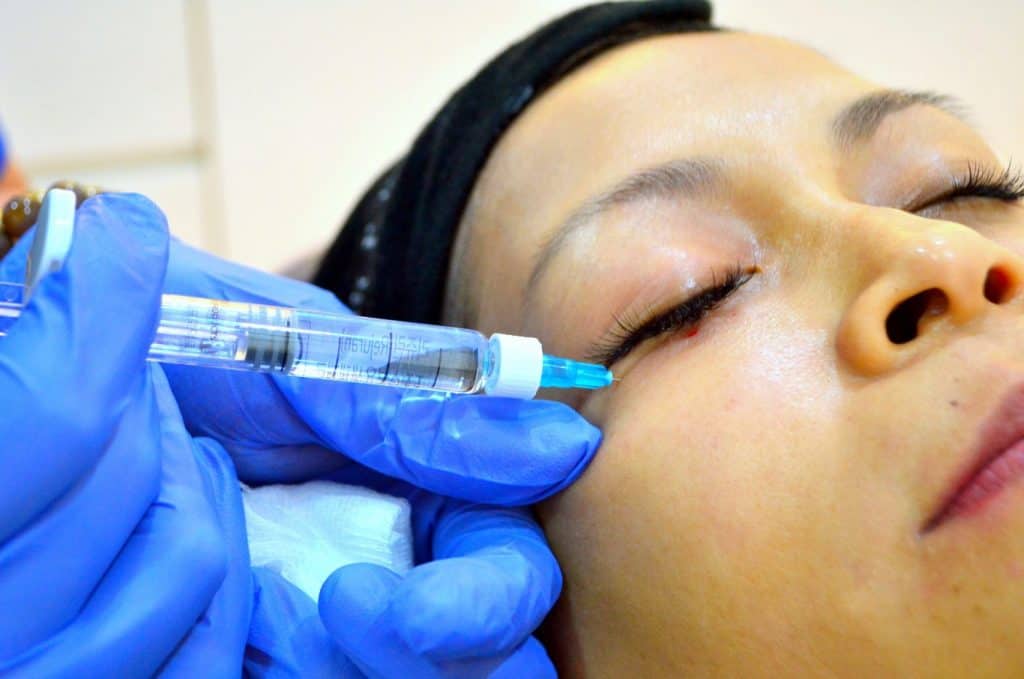 How to avoid Facial Overfilled Syndrome with fillers? 4 things you ...