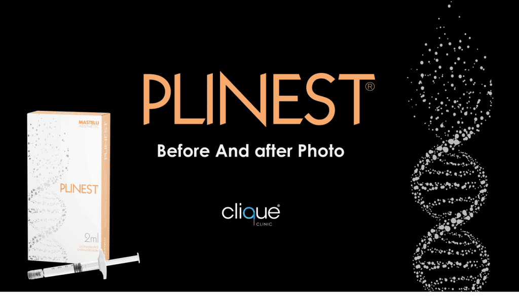 PLINEST For Men - 3 Treatments To Improve Skin Health | Clique Clinic