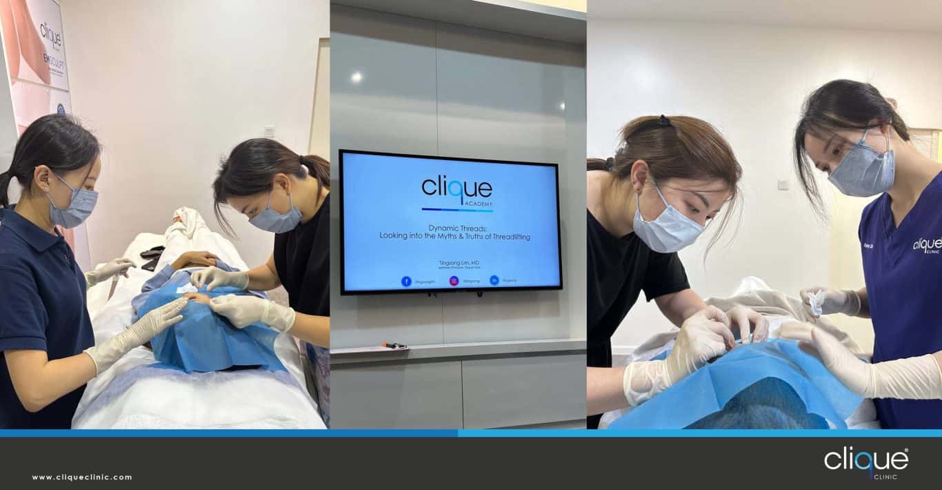 什么是铃铛线， Thread Lift(线雕)？ | Clique Clinic
