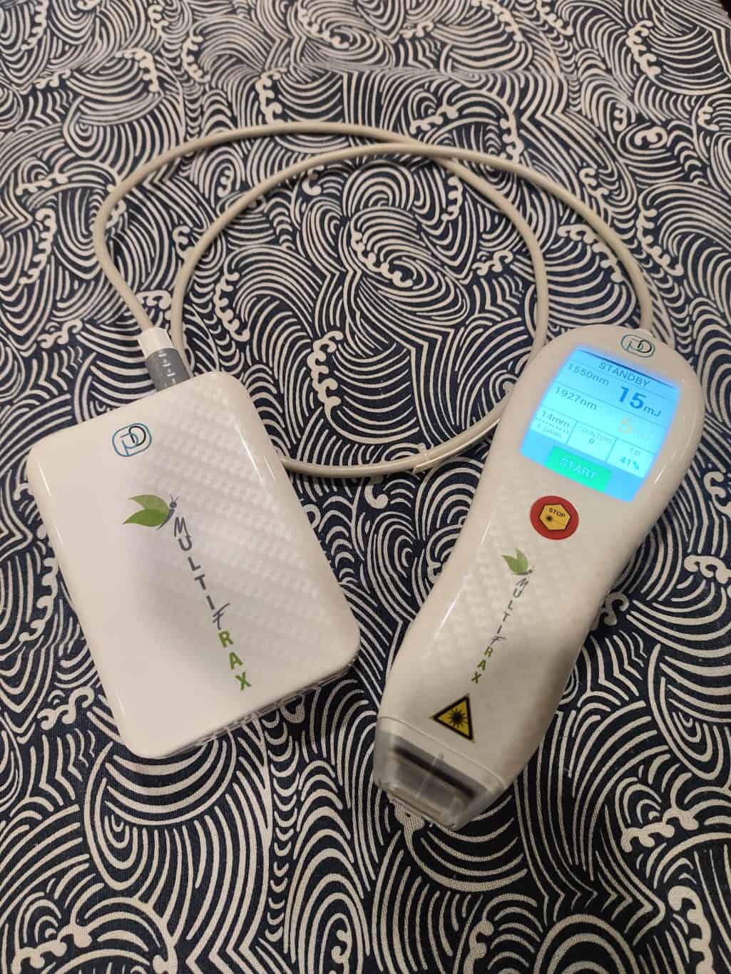 Digital Peel: MultiFrax Laser Treatment In Malaysia (KL & PJ)