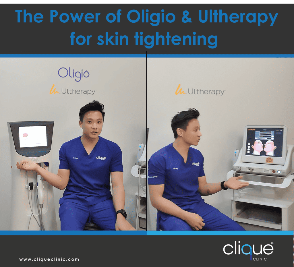 The Power Of Oligio Vs Ultherapy For Skin Tightening | Clique Clinic
